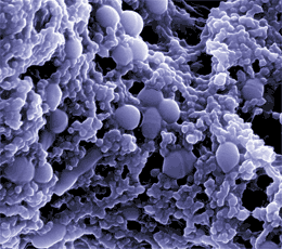 Microbiology: Lactobacillus