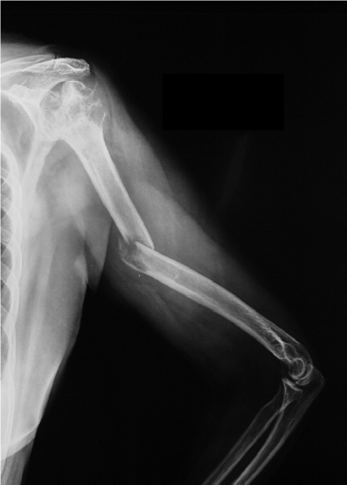 Traumatologia primeros auxilios