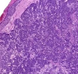 Dermatopathology Cases