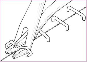 Nurse Base: REMOVING A STAPLE