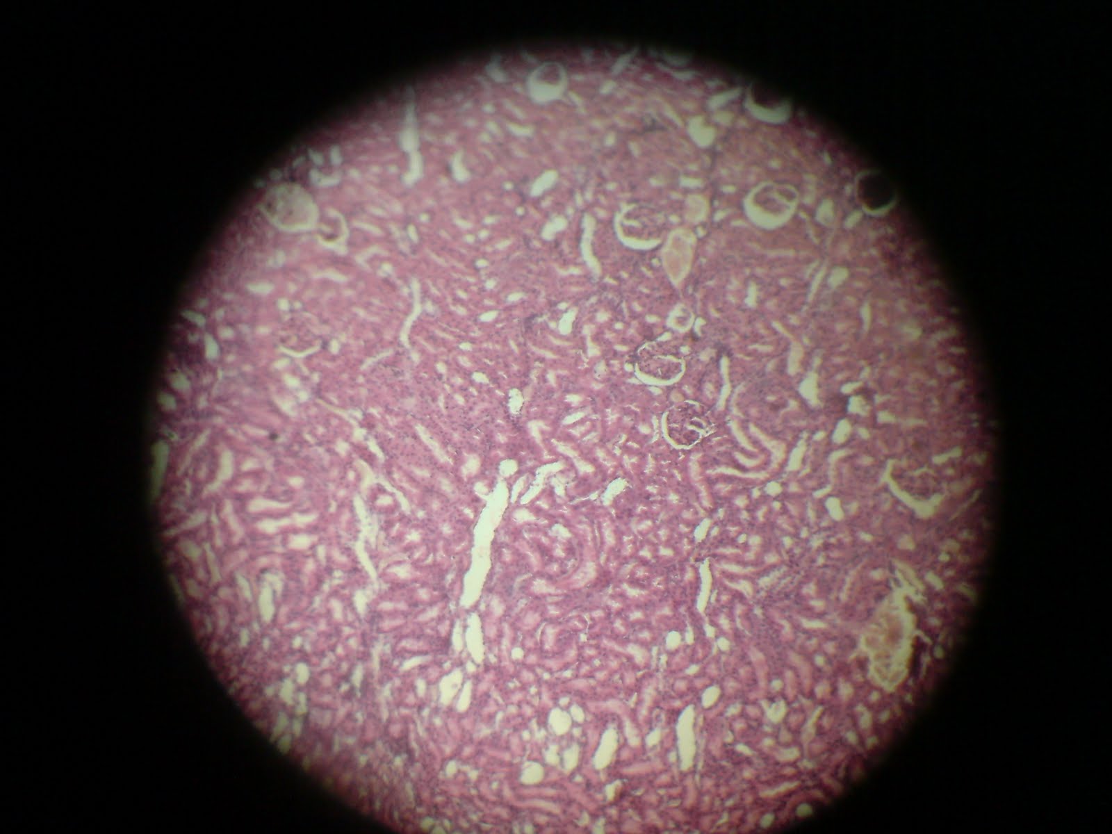 Gandhi Medical College: Histopathology Slides Part-I