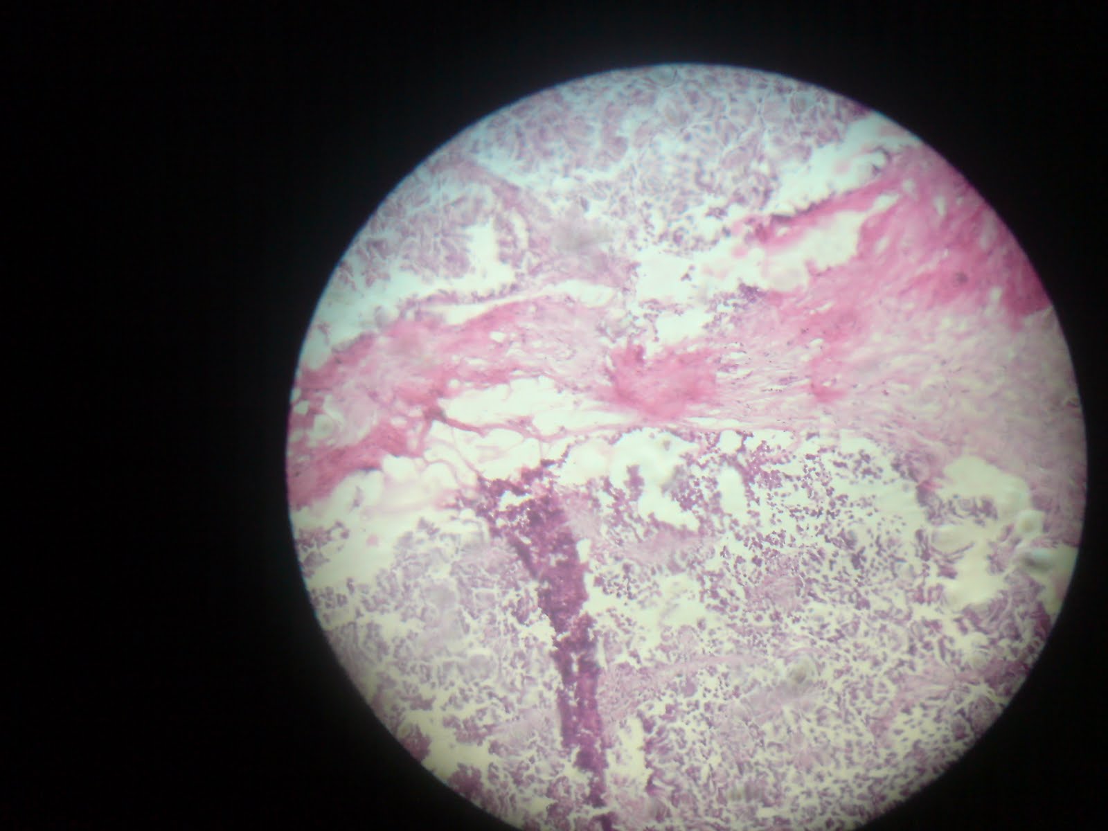 Gandhi Medical College: Histopathology Slides Part-II