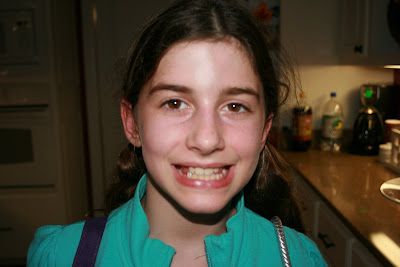 Madeline's JDM Story: Updated pics of Madeline's JDM rash