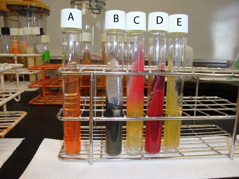 Microbiology: Triple Sugar Iron (TSI) Test