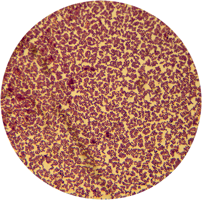 Microbiology: Genus: Staphylococcus