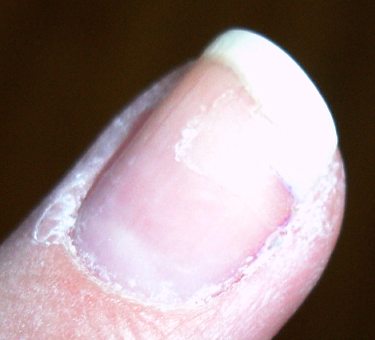 Polishology: Broken Nail Disaster and Repair Job