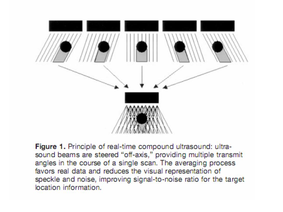 BÀI SOẠN VỀ SIÊU ÂM CHẨN ĐOÁN: SIÊU ÂM ĐA HƯỚNG / Spatial Compound ...