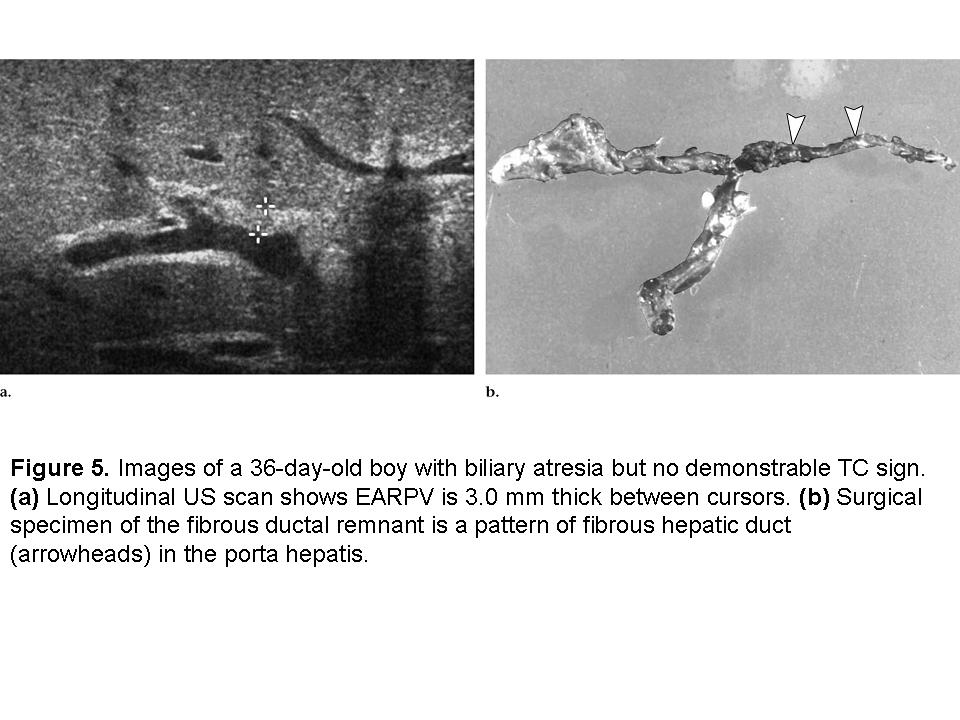 BÀI SOẠN VỀ SIÊU ÂM CHẨN ĐOÁN: TEO ĐƯỜNG MẬT và SIÊU ÂM CHẨN ĐOÁN