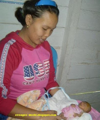 Strange World: This is true .......... small baby born