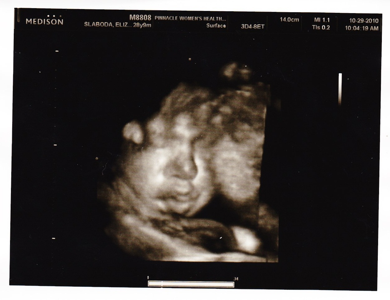 Bring it On, Baby!: 36 Weeks Ultrasound Pics
