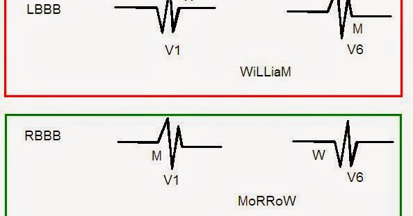 Score 99 USMLE blog: William Morrow in Bundle Branch Block