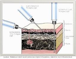 Protap Memberikan Obat Intravena (Injeksi IV)