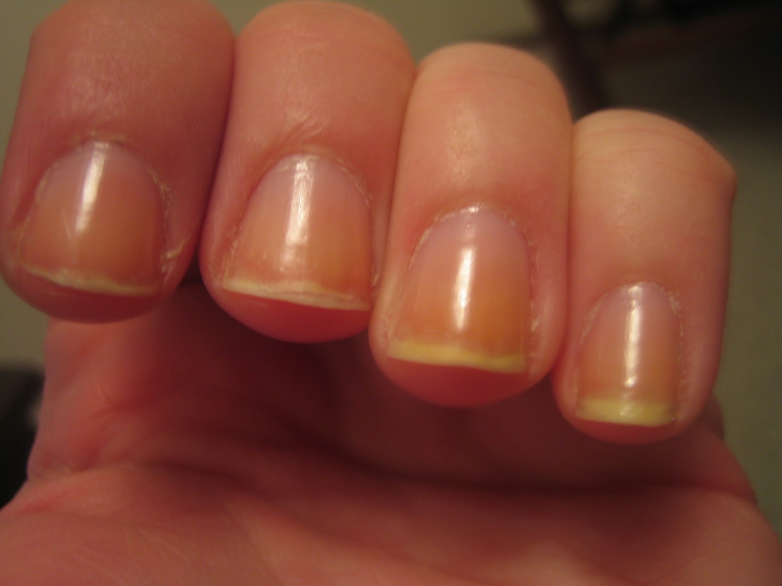 Alikat789 Nail art: My little unpolished broken nails