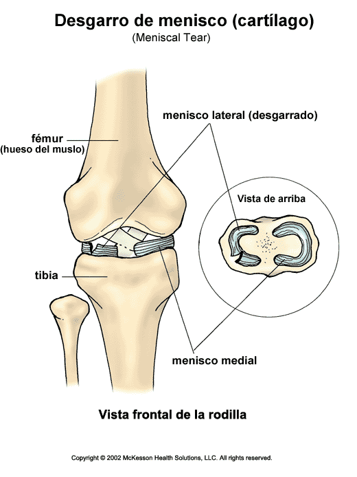Tipos de Articulaciones
