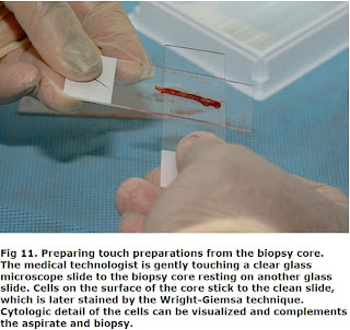 MadTechs: Bone Marrow Aspiration