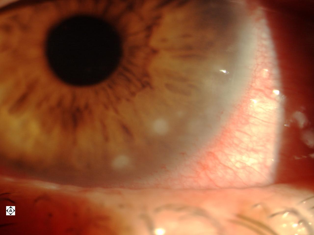 Sonoran Desert Eye Center: January 2011