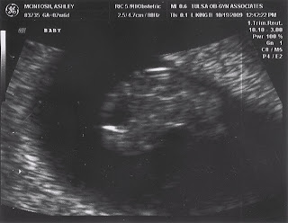 Life & Stuff: First Ultrasound! 8 weeks 3 days