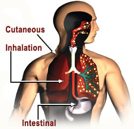 All About U DOCTOR: Anthrax Update on 30 September 2010