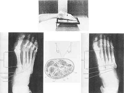 Jejak Radiologi: Teknik Pemeriksaan Pedis