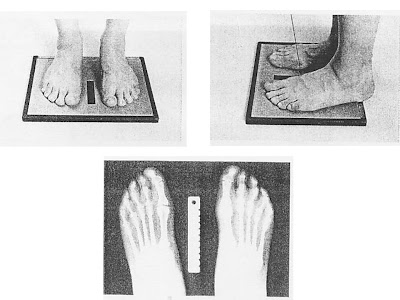 Teknik Radiografi Os. Pedis ~ SINAR-X RADIOLOGI
