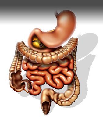 dunia xray: Teknik Radiografi Large Instestine/Usus Besar (Colon In Loop)