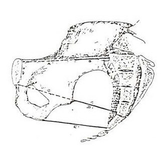 Seputar Radiologi: PELVIMETRI