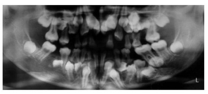 X-RAY: TEKNIK PEMERIKSAAN DENTAL RADIOGRAFI