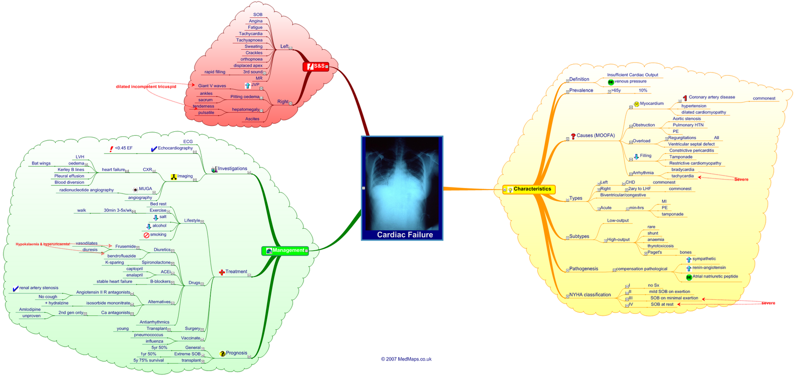Mind map of Cardiac Failure