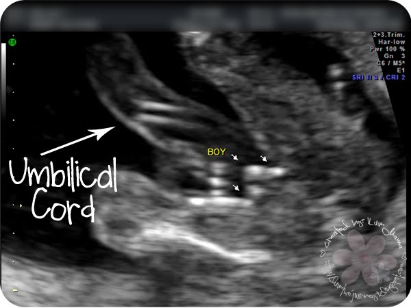 Luvn The Journey: June 2010