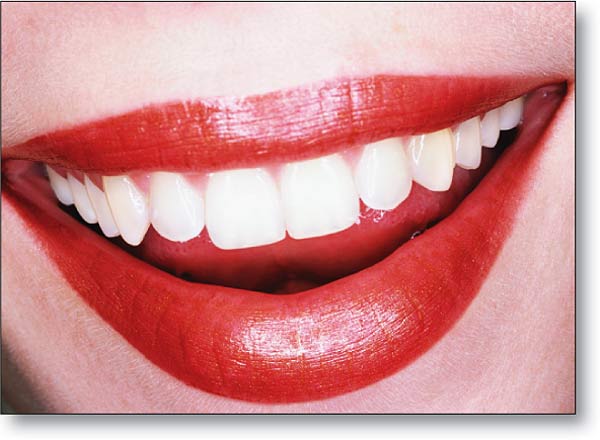 Consejos de Salud y Belleza: Dientes perfectos y saludables