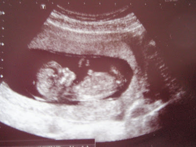 My Baby Journey: 11 Weeks and 4 Days