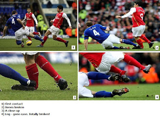 Mayz-ism: Broken Bones