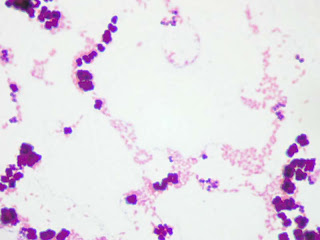MICROBIOLOGY LECTURE NOTES