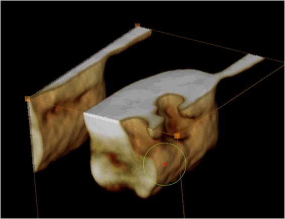 SEC - X-ray Inspection System: Copper Pillar Void Open Images (X-ray 3D CT)