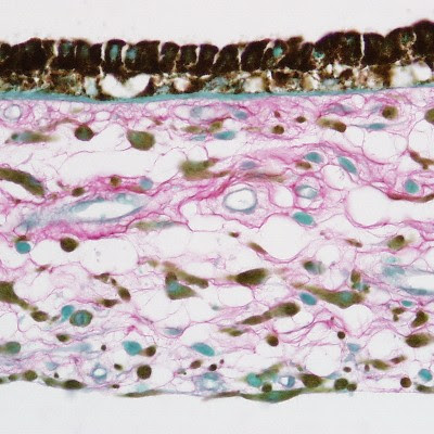 jeremy's stuff: Eye (histology slides)