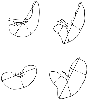 RadiologySpirit: splenic index
