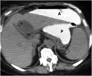 RadiologySpirit: 2010-04-25