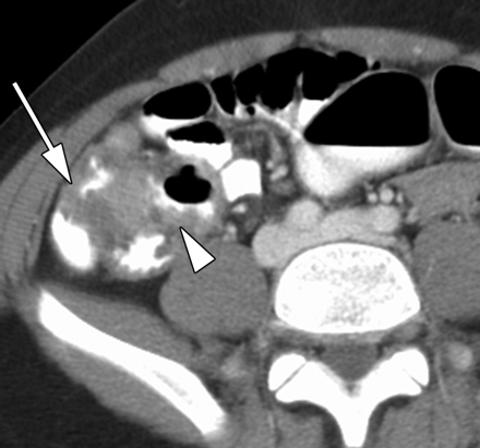 RadiologySpirit: 2010-06-06