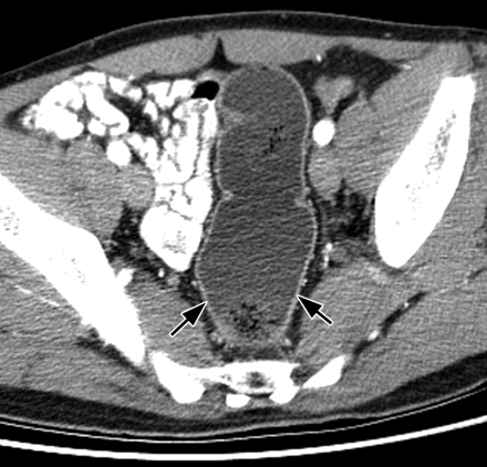 RadiologySpirit: 2010-06-06