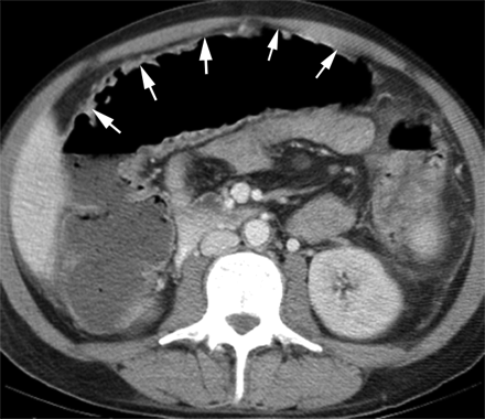 RadiologySpirit: 2010-06-06