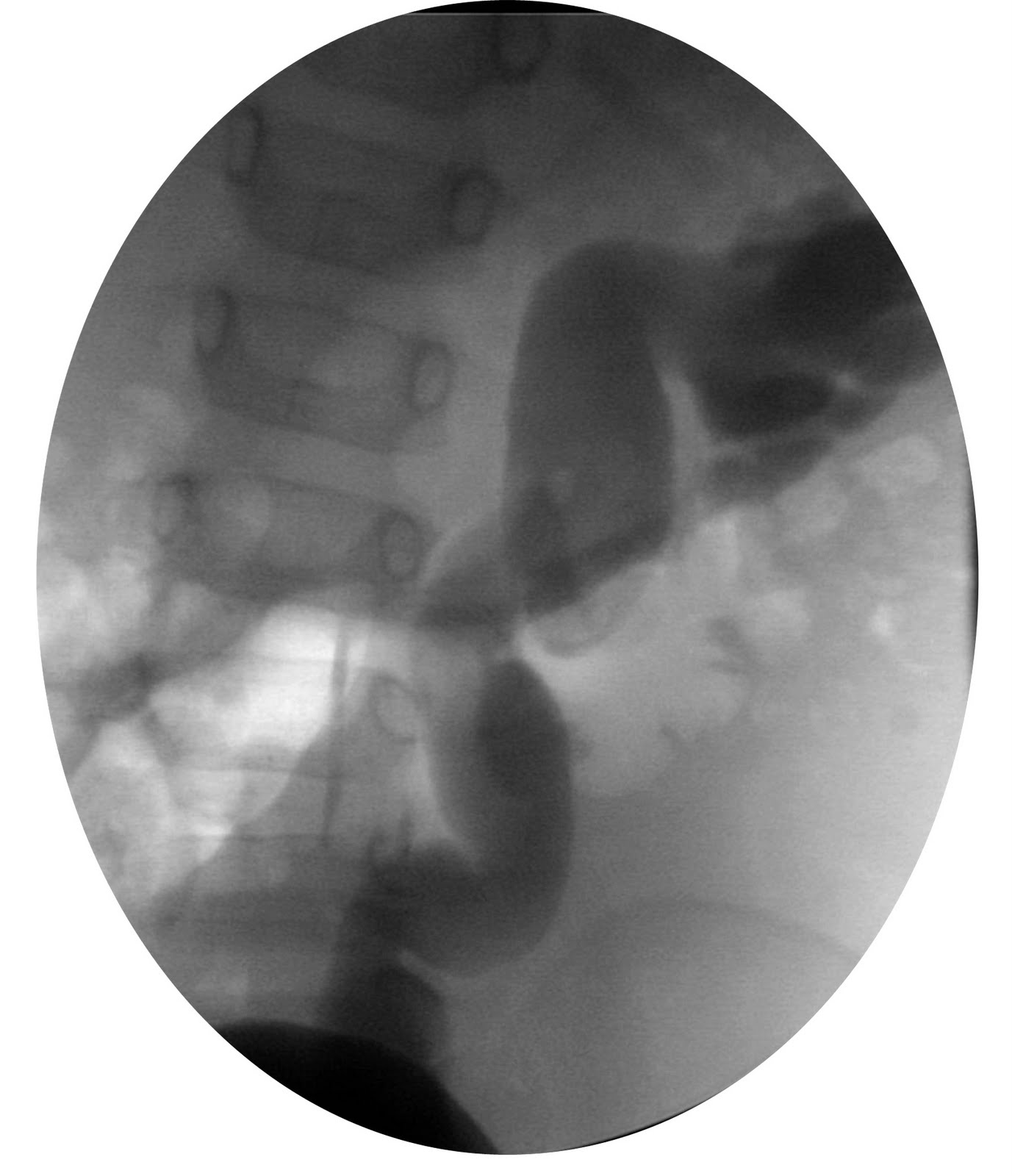 RadiologySpirit: 2010-07-04