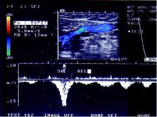 RadiologySpirit: 2010-07-11