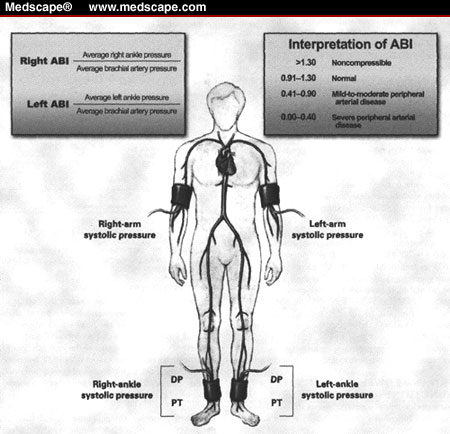 RadiologySpirit: 2010-07-11