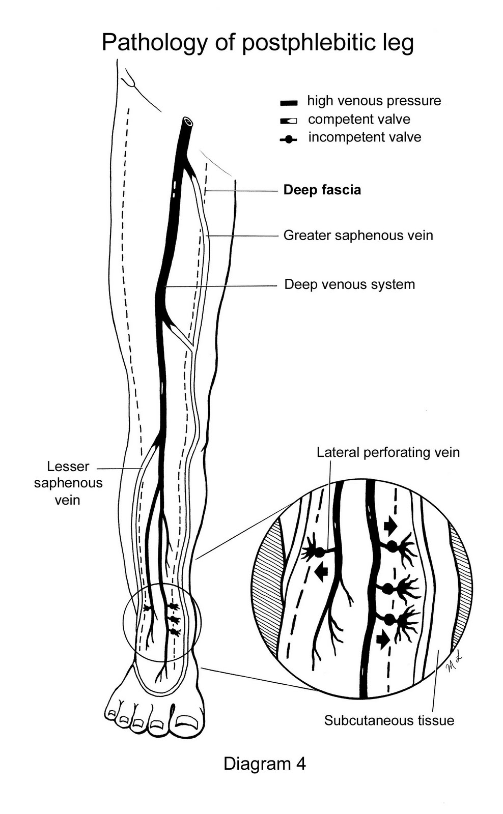Gaiter Region Of Leg Definition at Willie Liggins blog