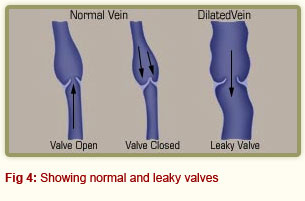 RadiologySpirit: 2010-07-11