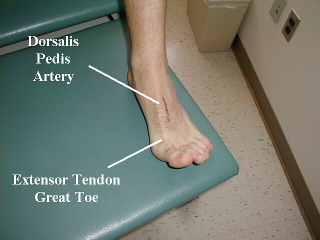 RadiologySpirit: Location of Dorsalis Pedis Artery