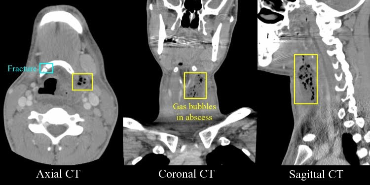 Radiologyspirit