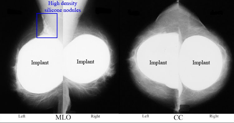 RadiologySpirit: 2010-07-25