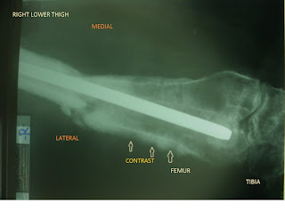 RadiologySpirit: sinogram