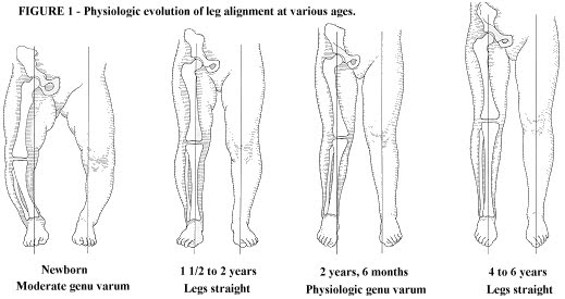 RadiologySpirit: tibial femoral angle